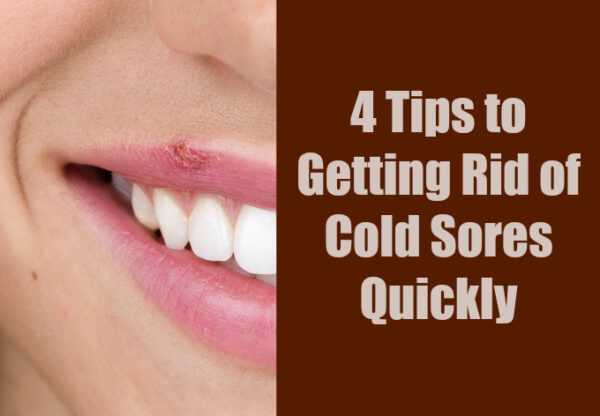 4 Tips to Getting Rid of Cold Sores Quickly ⋆ The Stuff of Success