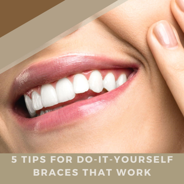 5 Tips for Do-It-Yourself Braces That Work ⋆ The Stuff of Success