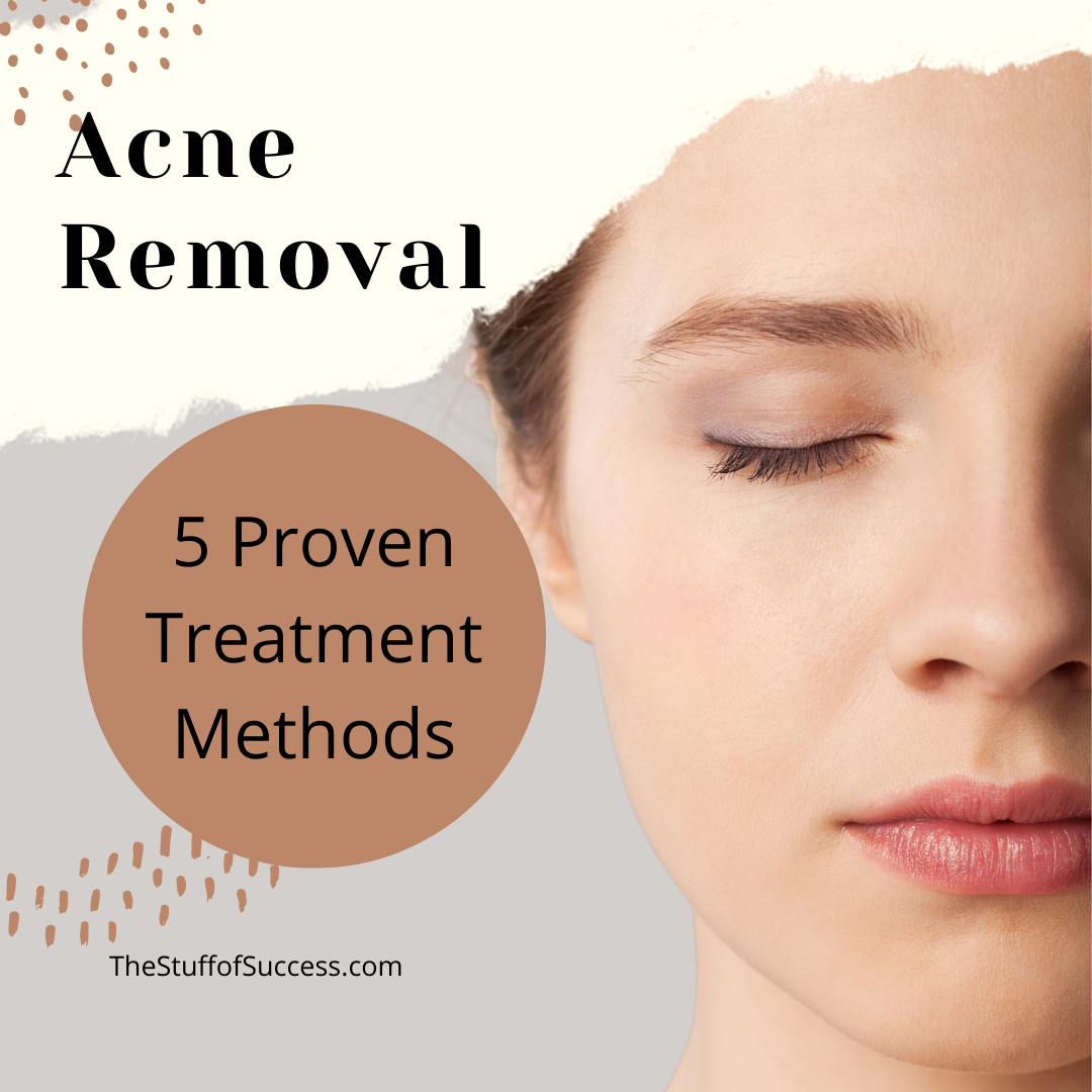 Acne Removal: 5 Proven Treatment Methods ⋆ The Stuff of Success